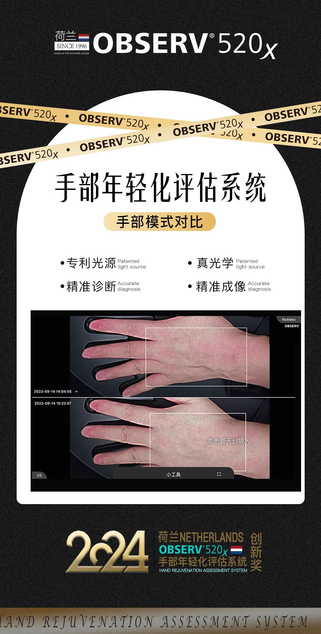 解锁手部年轻密码，OBSERV® 520X 让美触手可及 - 伊美高科